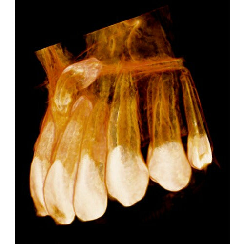 CARESTREAM CS 9000 3D PANOREX + CONE BEAM | HampMED