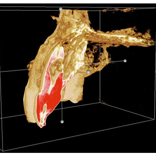 CARESTREAM CS 9000 3D PANOREX + CONE BEAM | HampMED