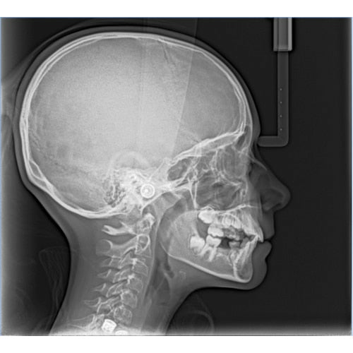 CARESTREAM CS 9000C 3D PANOREX + CEPH + CONE BEAM | HampMED